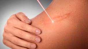 Schönheitsoperationen - Haut